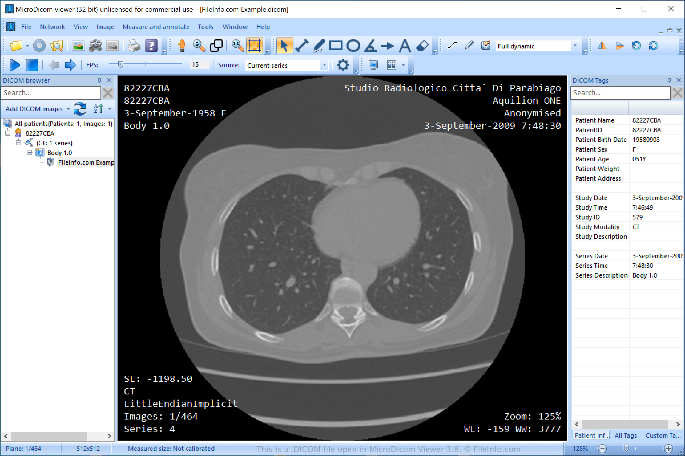 DICOM File Extension What Is A dicom File And How Do I Open It 
